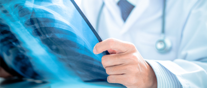 Unlocking the Hidden Benefits of Digital Motion X-Rays in Rochester